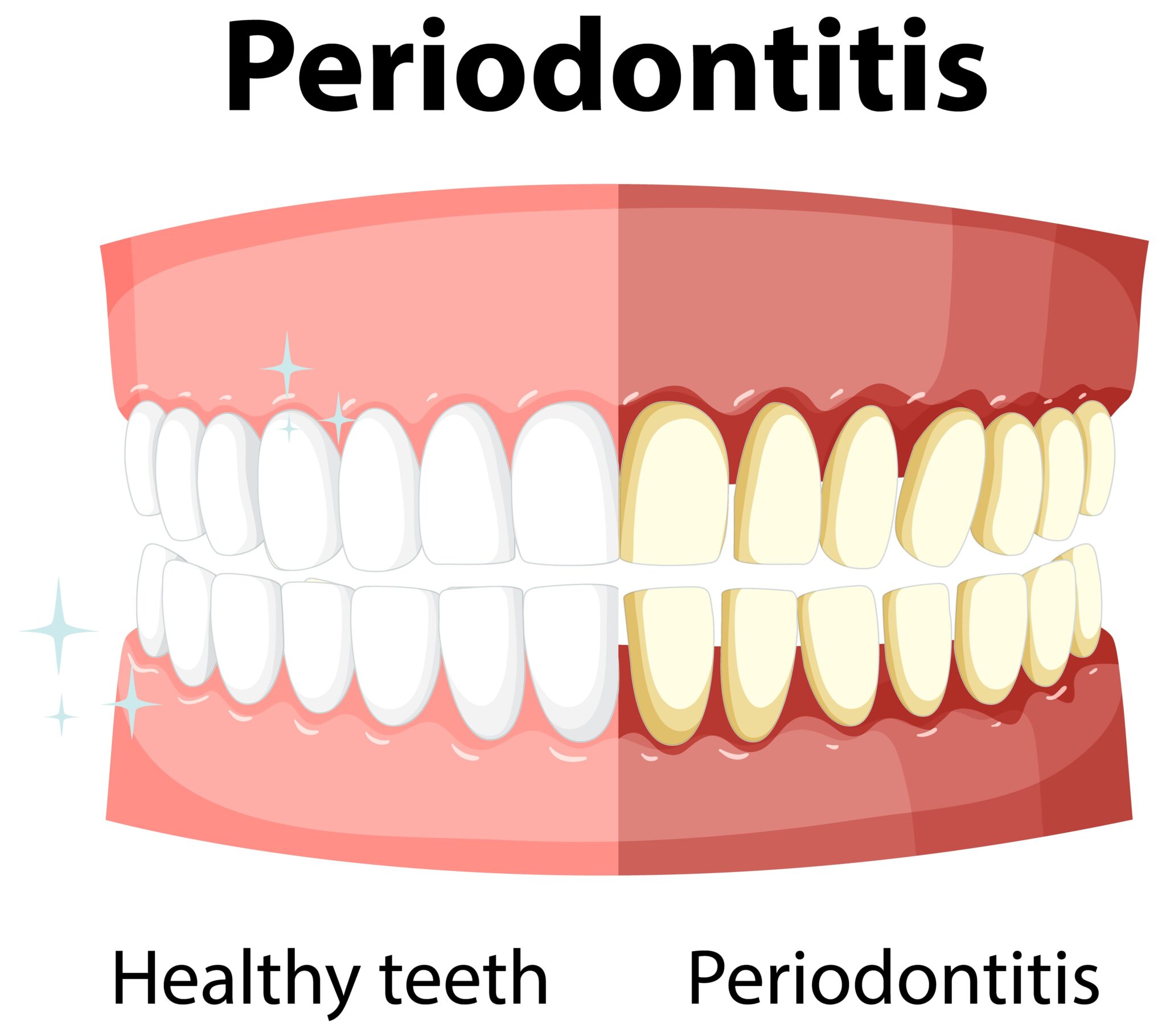 Swollen Gums with Braces? Here’s How to Soothe and Heal Fast